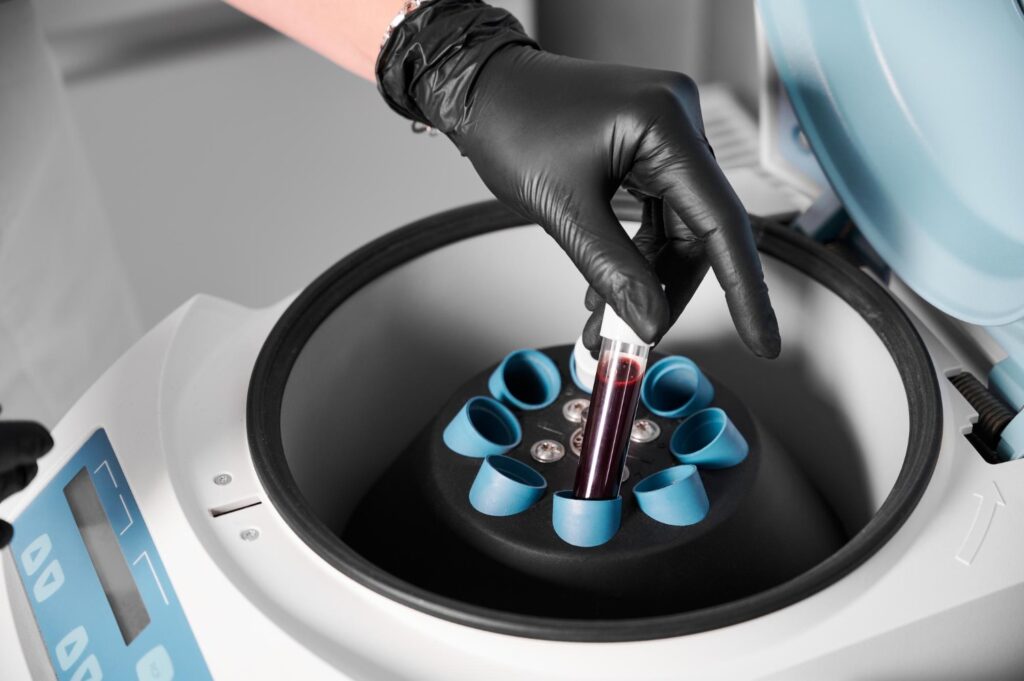 preparation-blood-injections-cosmetologist-puts-tube-blood-centrifuge (1)